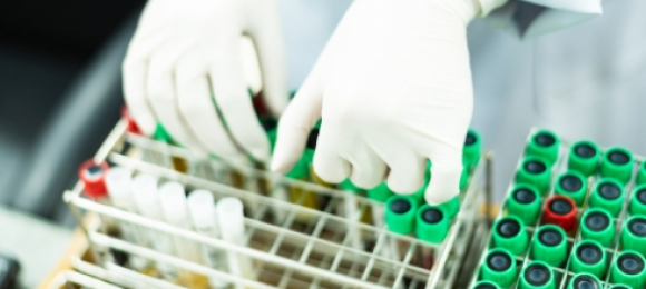 How to... reduce your lab's plastic waste